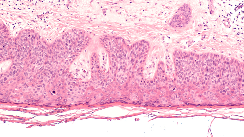 Dermatopathology Lab - Core Dermatology