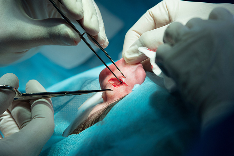 Ear Revision - Core Dermatology